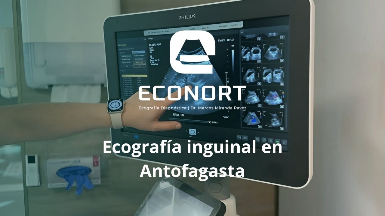 Eco Inguinal en ECONORT: Diagnóstico preciso de hernia